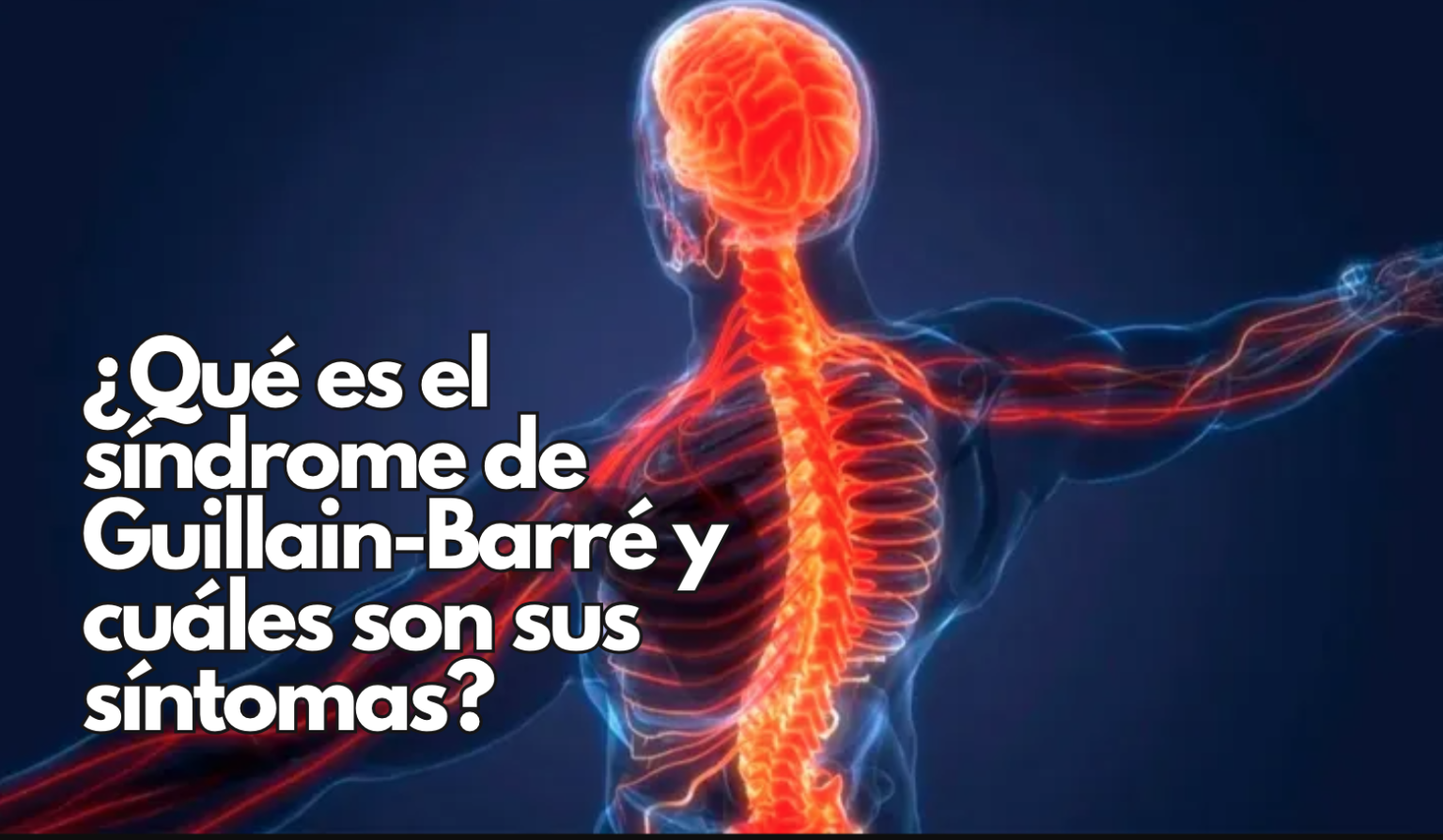 ¿Qué es el síndrome de Guillain-Barré y cuáles son sus síntomas ...